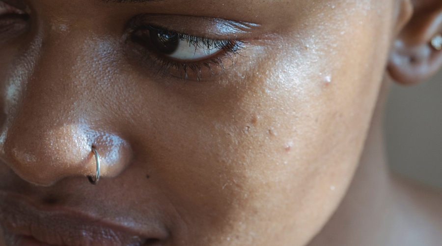 Prevent and Treat Ingrown Hairs on Your Face with Shea Butter Stick